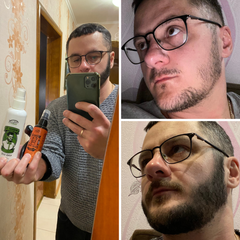 Купити комплекс для росту бороди посилений - MinoX.ua